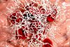 Hemostase | De drie stadia - Huisartsgeneeskunde