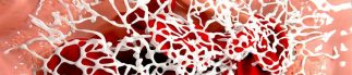 Hemostase | De drie stadia - Huisartsgeneeskunde